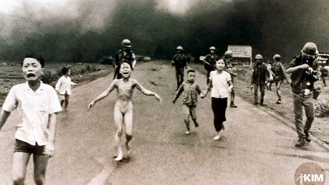 Famous â€˜Napalm Girl’ receives final burns treatment – OverSixty